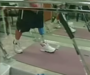 Prosthetics | Artificial Limbs | Limb Replacement For Amputees