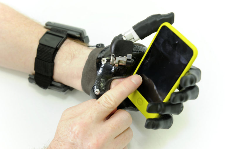 Hand Prosthetics | i-LIMB Artificial Hand | Bionic Limbs