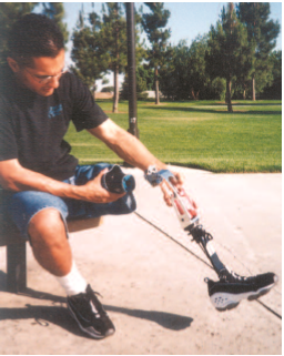 Specialty Lower-Limb Prostheses – Special-Purpose Prosthetic Legs