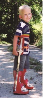 Orthotics For Children And Pediatric Orthotic Applications For Kids