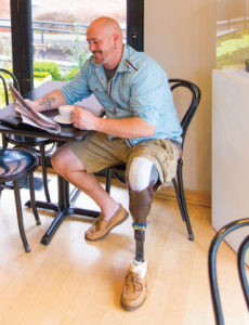 Prosthetic Science Creates Replacement Limbs In Texas